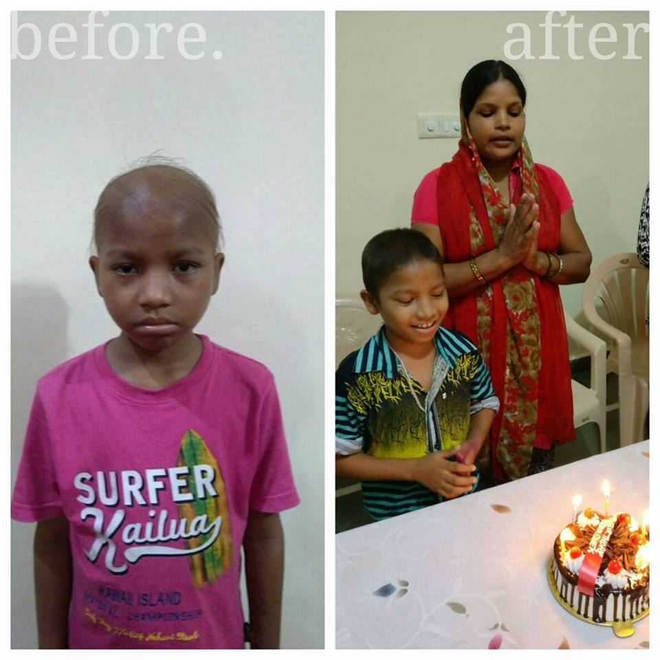 Ashish Life is Saved! – Serve International